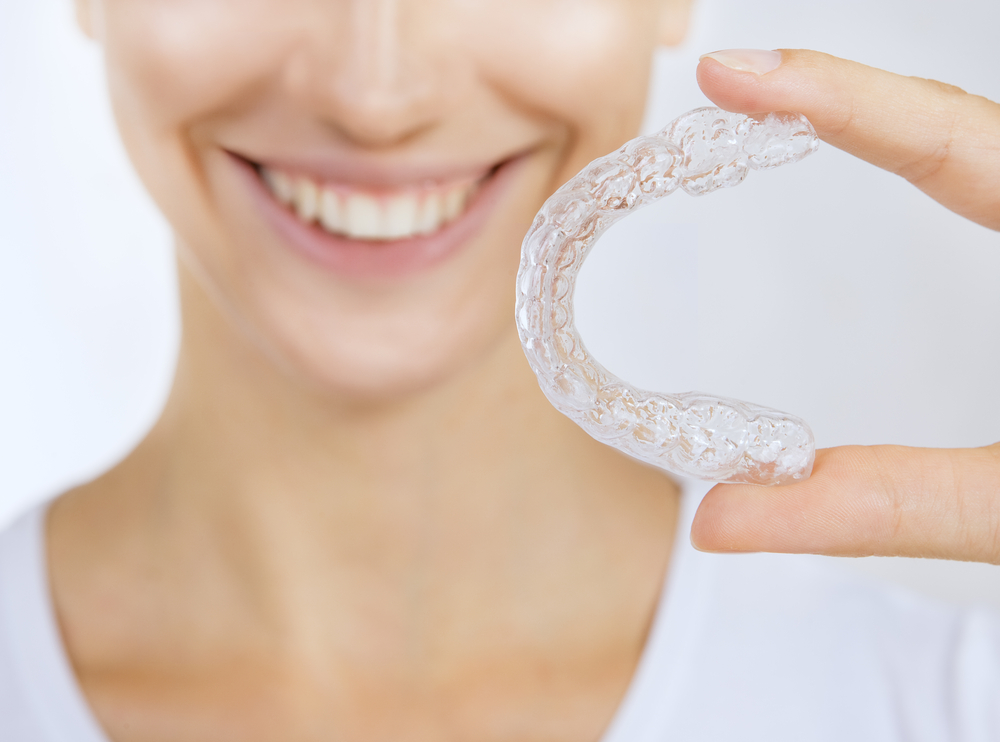 Invisalign Clear Braces in Newport Beach Orange County CA